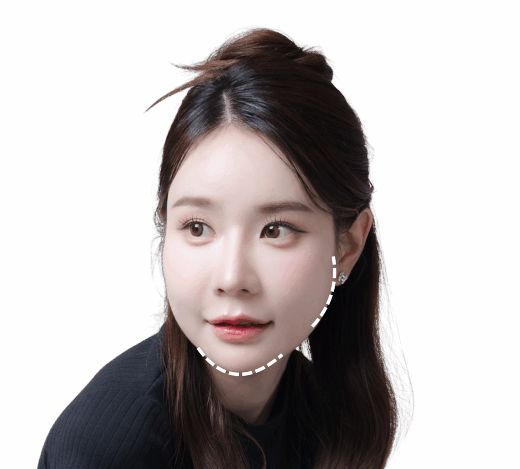 Face Contouring in Korea - The Plus Plastic Surgery in Gangnam